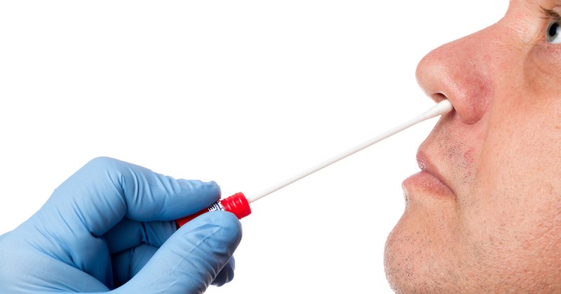 Uzimanje brisa grla, nosa i usne šupljine