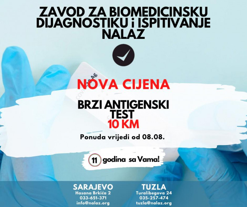 NALAZ Laboratorija | Mikrobiologija Imunologija Biohemija Genetika